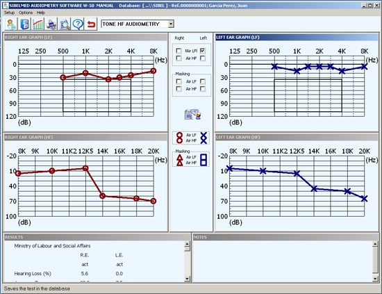Audiometr Sibelsound SS-400 AOM Diagnostyczny, Przewodnictwo Powietrzne ...